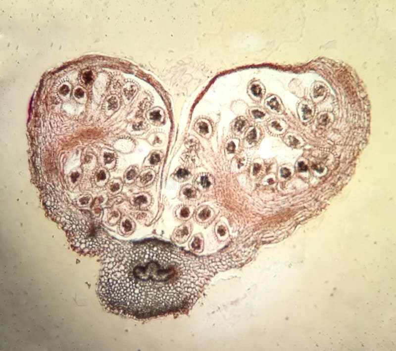 Fern Sorus Cross Section. Incision through the Fern Sorus Under a ...