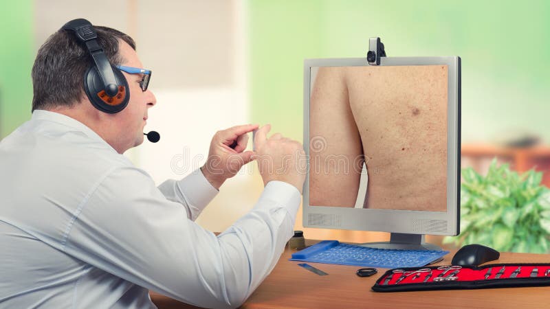 Fernmedizindermatologe, Der Sebaceous Zyste Auf Monitor Schaut ... Fernmedizindermatologe, Der Sebaceous Zyste Auf Monitor Schaut ...