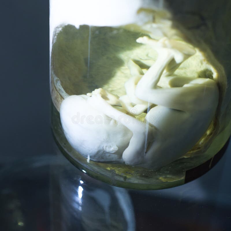 Fetus in formalin solution stock photo. Image of embryo - 142259406