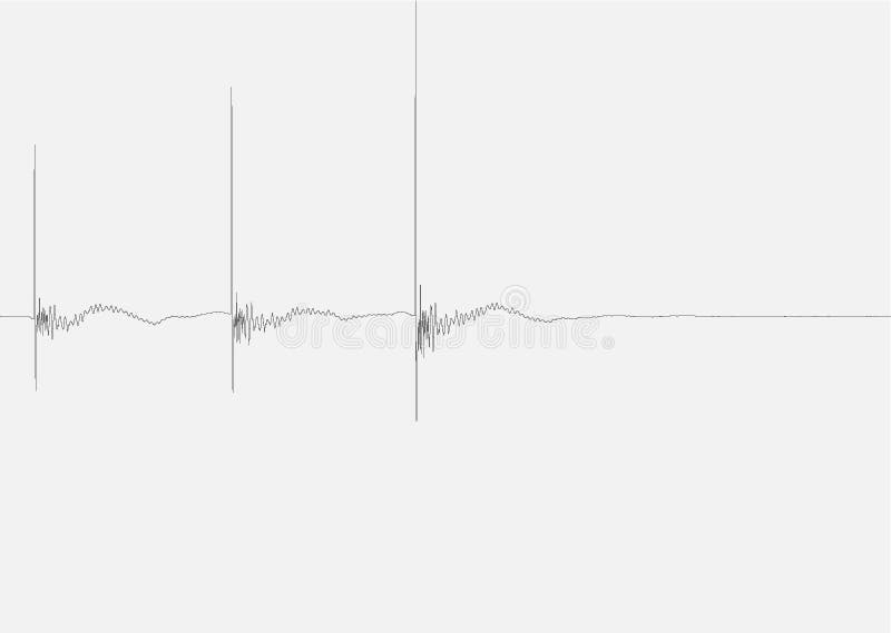 Royalty-Free Fiat Doblo 2000 Panel Van Window Knock Inside Stock Music ...