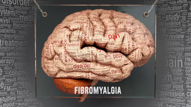 Fibromyalgia Ideas Stock Illustrations – 10 Fibromyalgia Ideas Stock ...