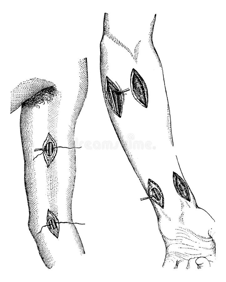 Fig. 760. - Showing the Different Points at Which the Arm Can Be Stock ...