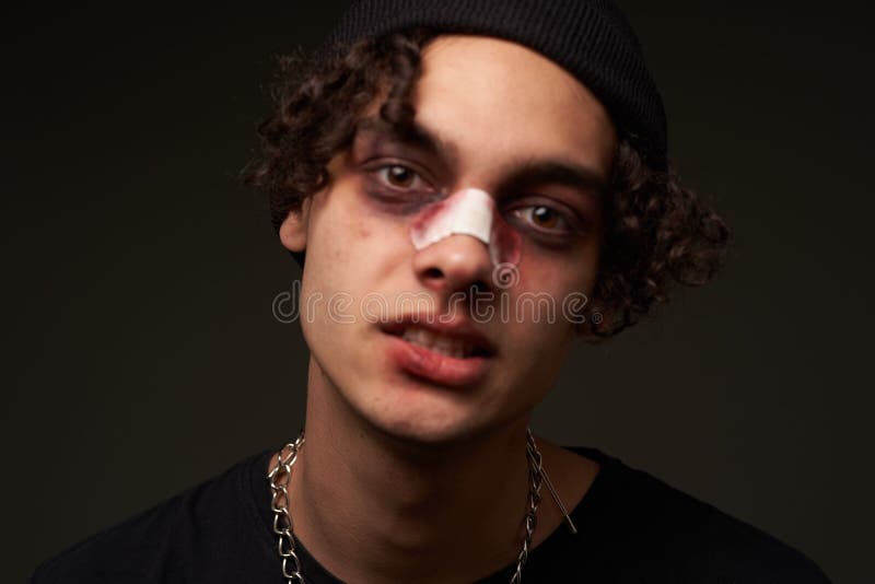 Fighter with Broken Nose Training Boxing Conflict Aggression Injury ...