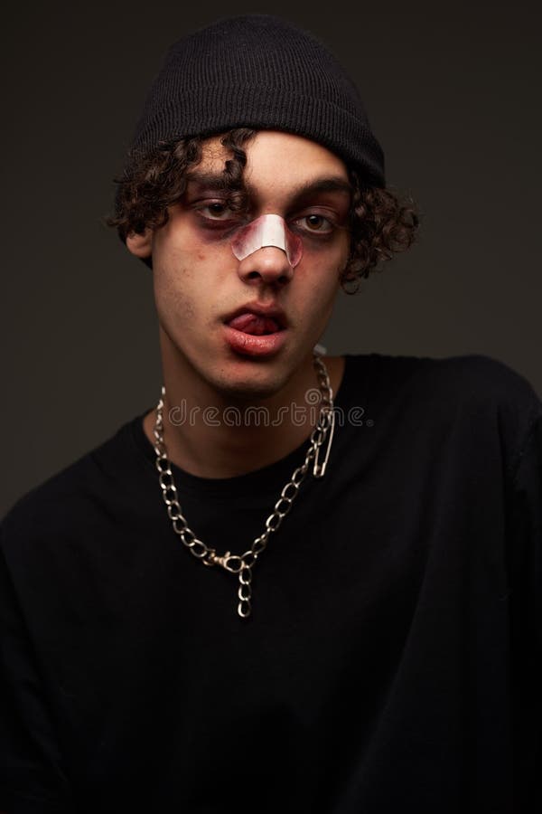 Fighter with Broken Nose Training Boxing Conflict Aggression Injury ...