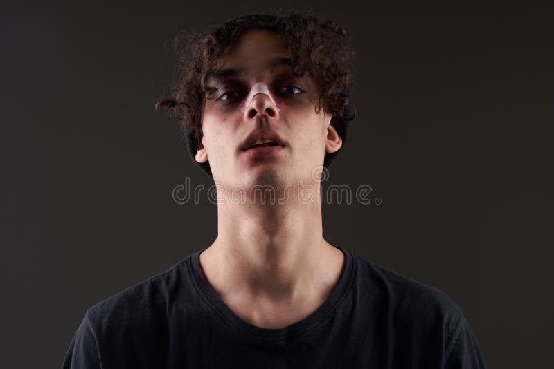 Fighter with Broken Nose Training Boxing Conflict Aggression Injury ...