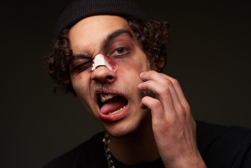 Fighter with Broken Nose Training Boxing Conflict Aggression Injury ...