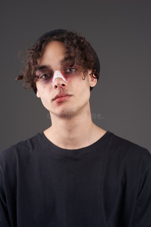 Fighter with Broken Nose Training Boxing Conflict Aggression Injury ...