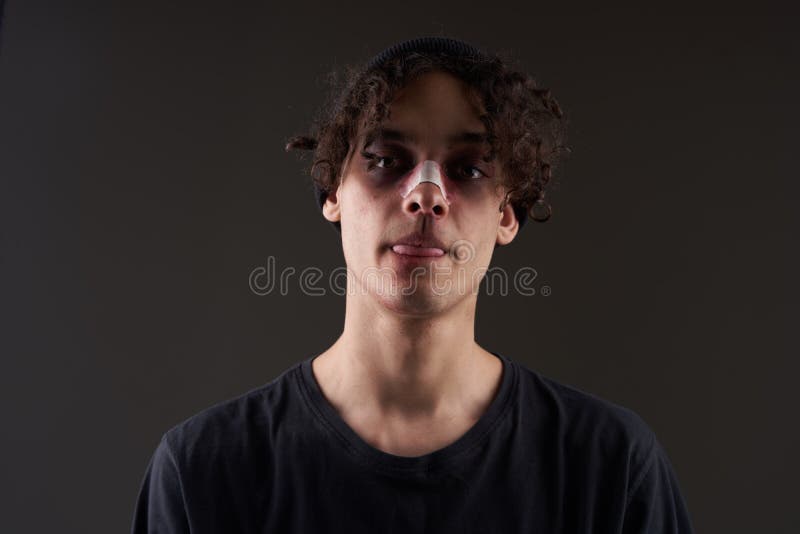 Fighter with Broken Nose Training Boxing Conflict Aggression Injury ...