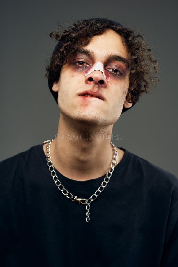 Fighter with Broken Nose Training Boxing Conflict Aggression Injury ...