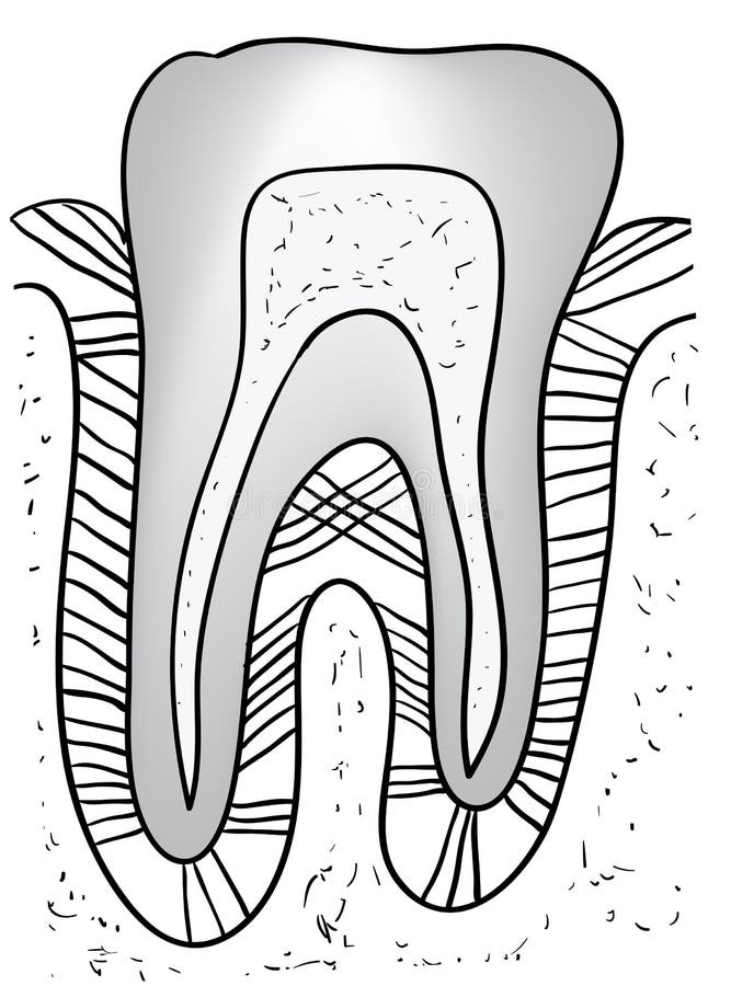 Figure tooth gum vector stock vector. Illustration of implant - 42246042