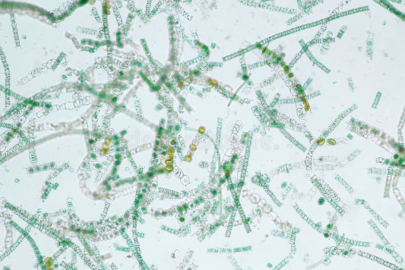 Filamentous Algae are Single Algae Cells that Form Long Visible Chains ...