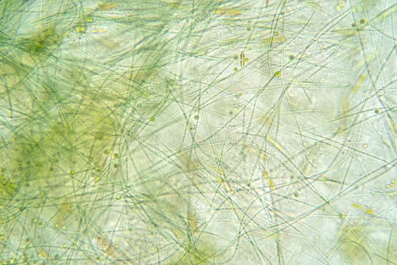 Filamentous Algae are Single Algae Cells that Form Long Visible Chains ...