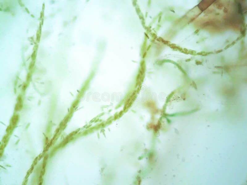 Filamentous Algae are Single Algae Cells that Form Long Visible Chains ...