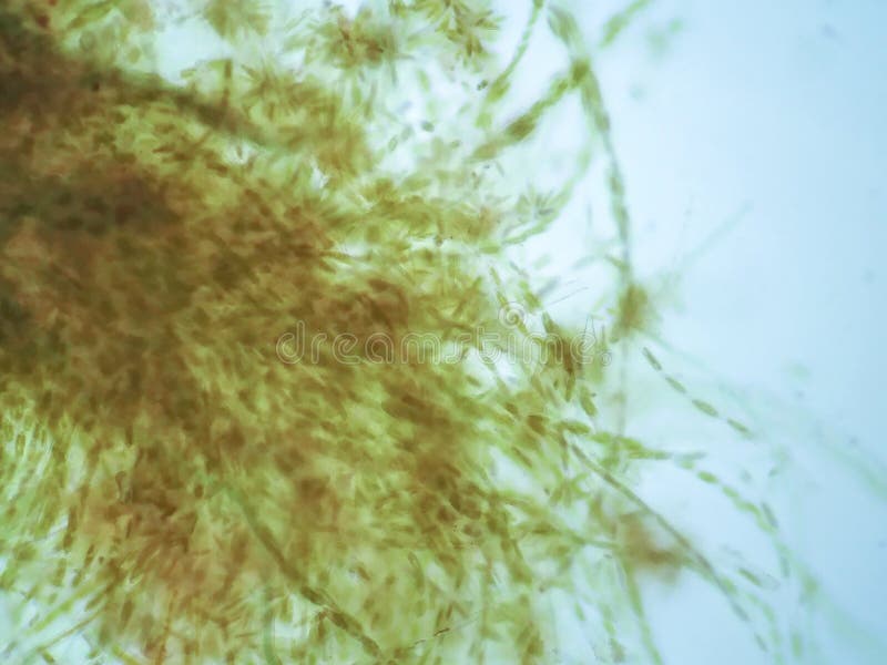 Filamentous Algae are Single Algae Cells that Form Long Visible Chains ...
