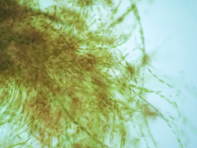 Filamentous Algae are Single Algae Cells that Form Long Visible Chains ...