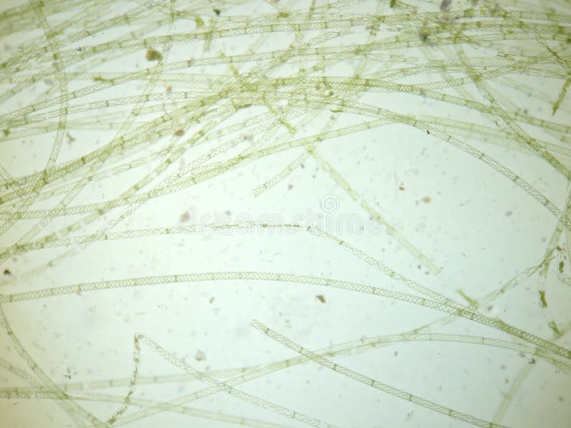 Filamentous Algae are Single Algae Cells that Form Long Visible Chains ...