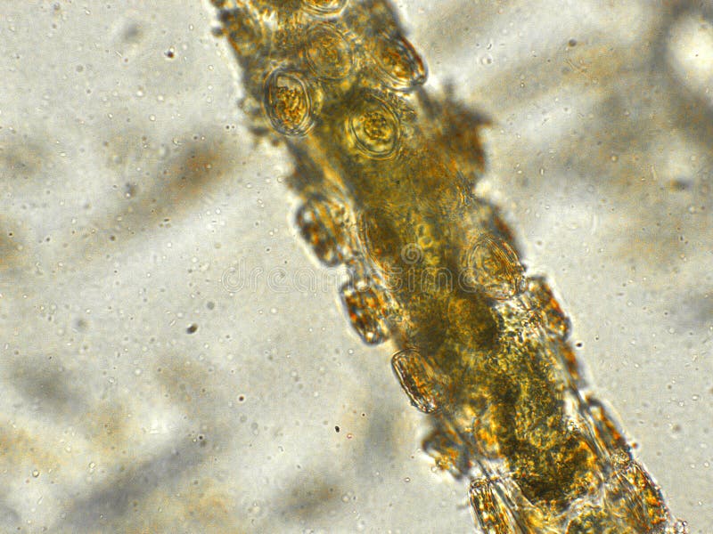 Spirogyra Sp. Green Algae Under Microscopic View X40 - Chlorophyta ...