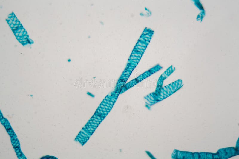Spirogyra Under Microscope 100x