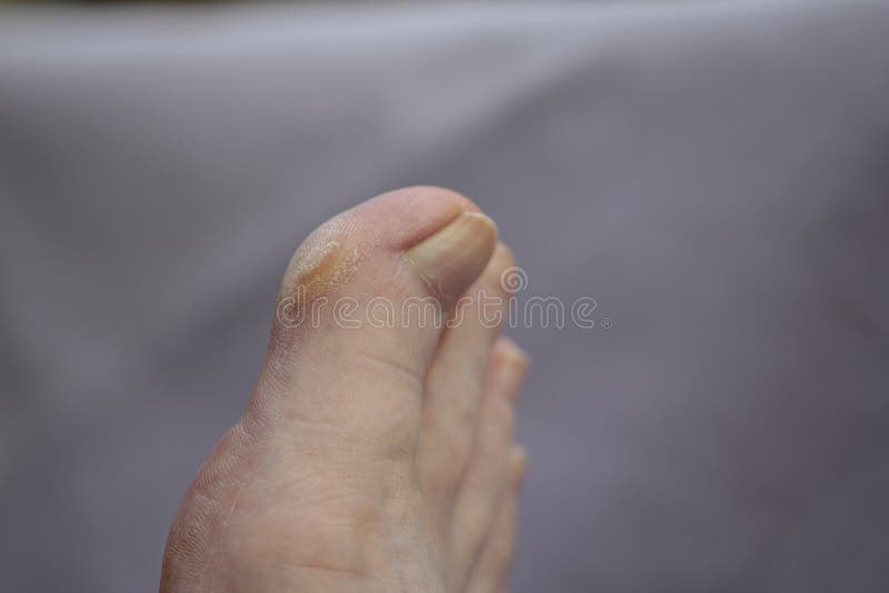 With the file on the toe stock photo. Image of toes - 120610536