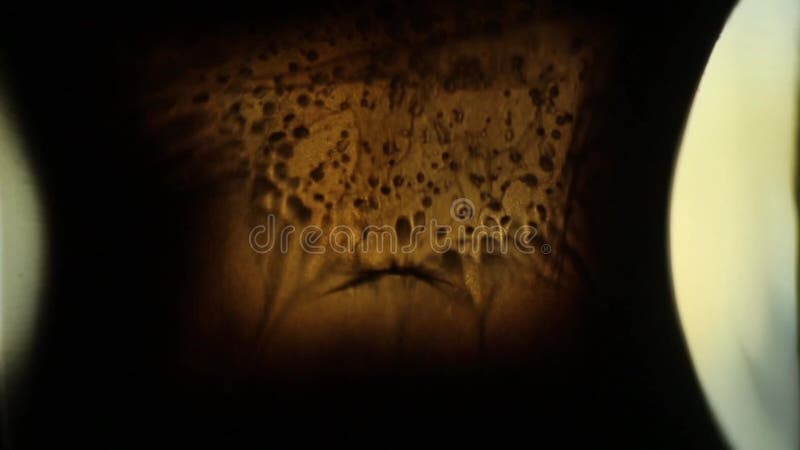 Film Burning In Projector