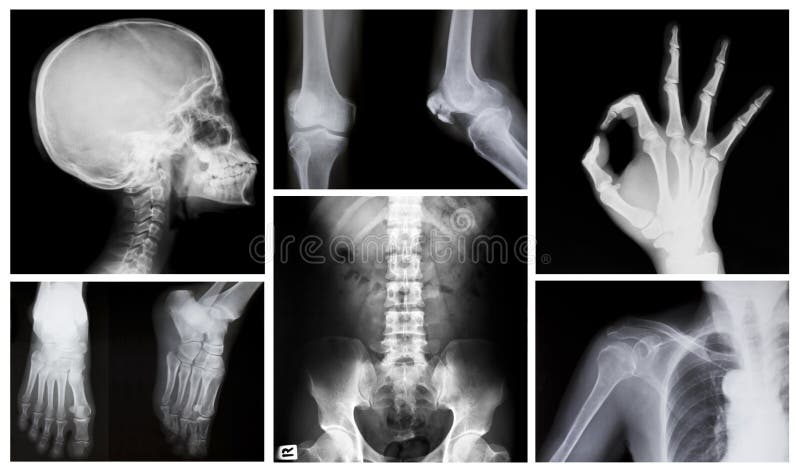 Film radiographique image stock. Image du main, patient - 34127597
