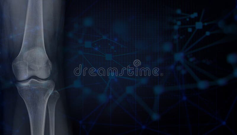 Film X-ray of Left Knee Joint AP View for Medical Background 3D ...