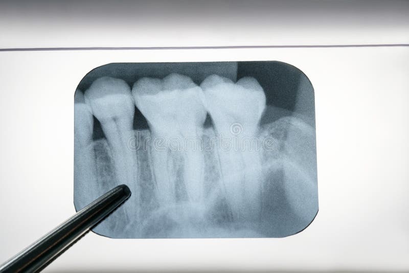 Bw Graph Stock Photos - Free & Royalty-Free Stock Photos from Dreamstime