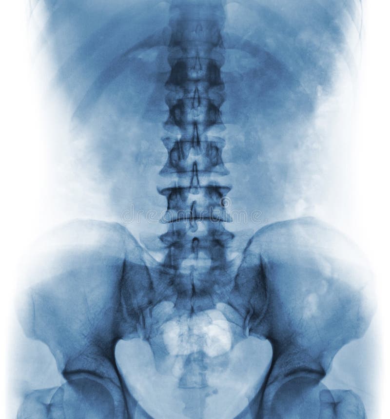 Back View Normal Lumbar Spine Stock Photos - Free & Royalty-Free Stock ...