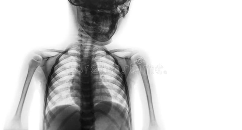 Upper Half Of Human Skeleton On White Stock Photo - Image of chest ...