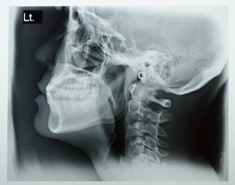 Film stock photo. Image of shadow, sick, rays, hospital - 79282828