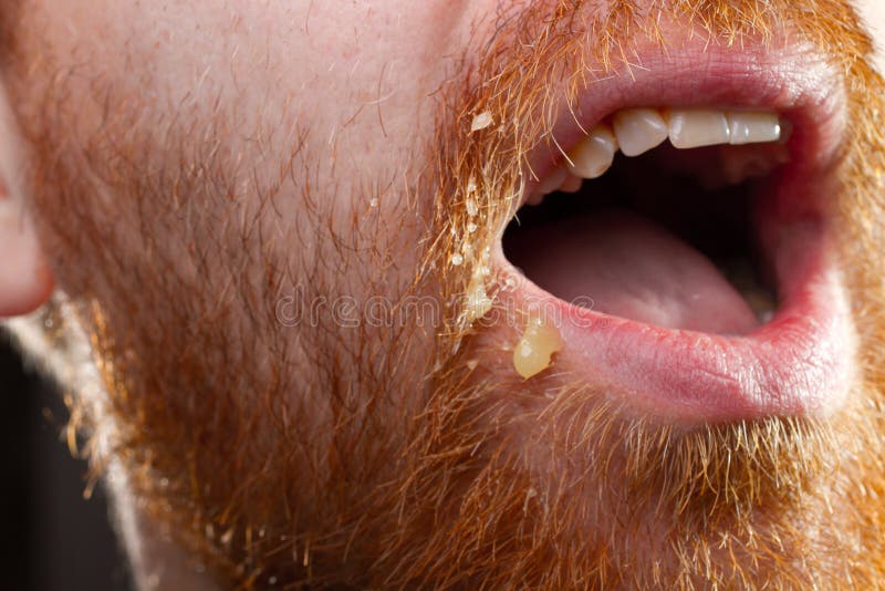 Filthy beard stock photo. Image of meal, bite, hair, sticky - 41321018