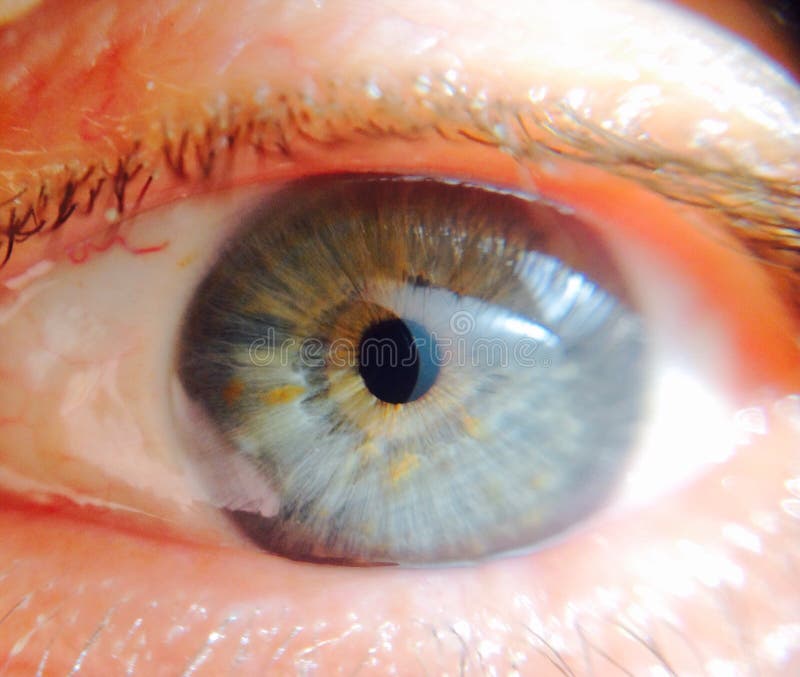 Bola do olho imagem de stock. Imagem de esfera, saúde - 74717375
