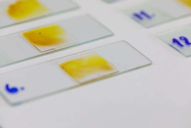 Finding Parasites in Feces. Stock Photo - Image of filter, medicine ...