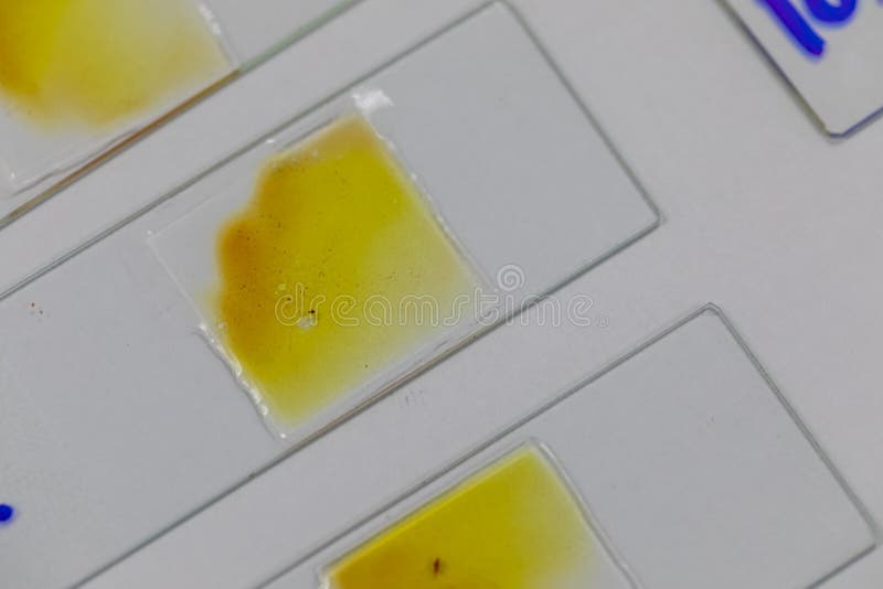 Finding Parasites in Feces. Stock Photo - Image of diagnose, helminth ...