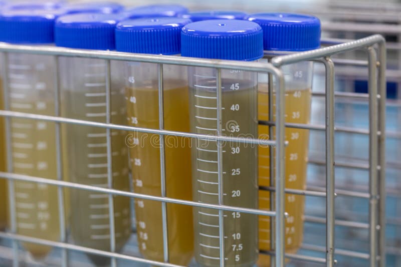 Finding Parasites in Feces. Stock Image - Image of helminth, fresh ...