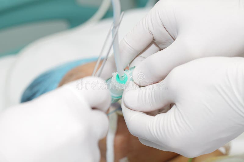 Fine work of medical staff stock photo. Image of exhibition - 28174004