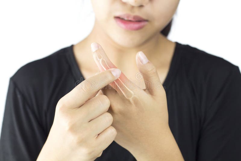 Finger bone pain stock photo. Image of ache, injury - 149137570