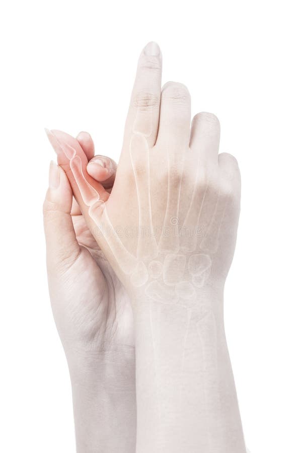 Finger bone pain stock image. Image of disease, painful - 150683513