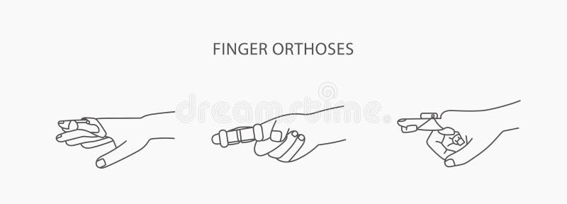 Finger Orthoses Stock Illustrations – 14 Finger Orthoses Stock ...