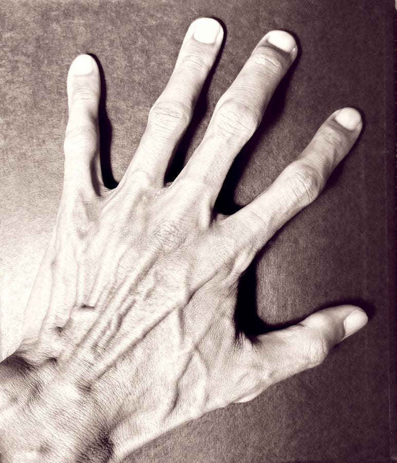 Finger tendon stock image. Image of tendon, prominently - 304409947