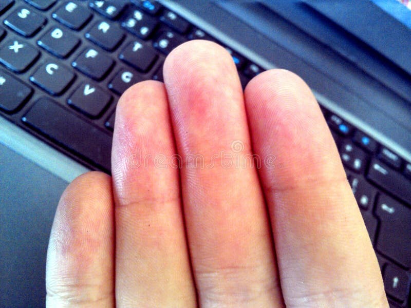 Fingers Above the Notebook Keyboard Stock Image - Image of computer ...