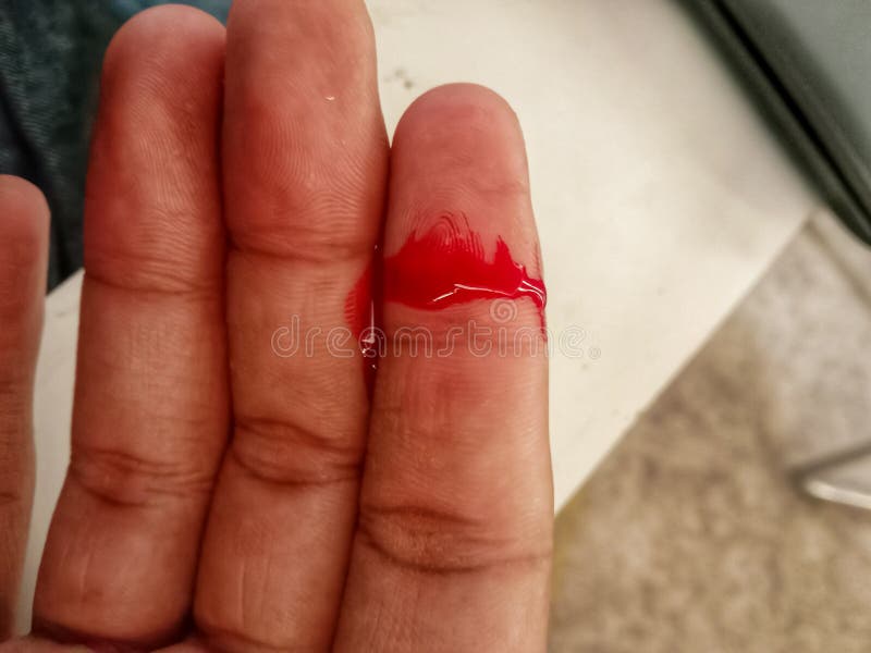 Fingers are Injured and Bleeding from Sharp Objects Stock Photo - Image ...