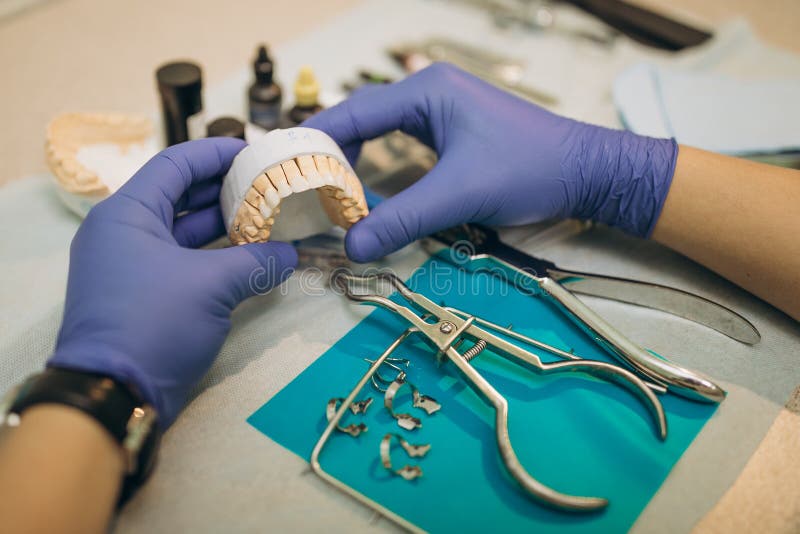 Finished New Ceramic Bridge on Plaster Model, Frontal View Stock Photo ...