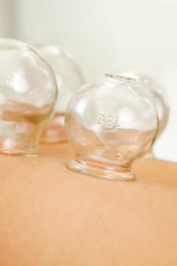 4,841 Cupping Photos - Free & Royalty-Free Stock Photos from Dreamstime