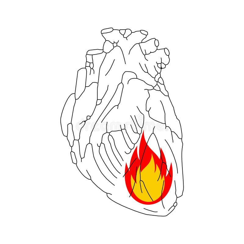 Fire in Heart. Flame in an Anatomical Heart Stock Vector - Illustration ...