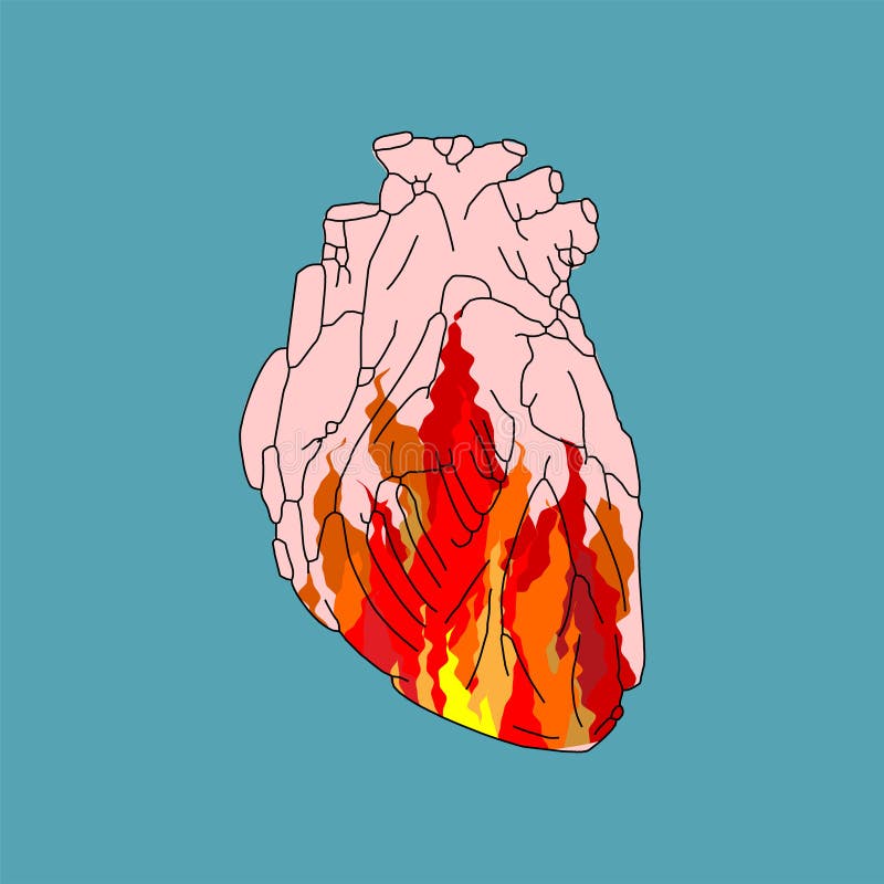 Fire in Heart. Flame in an Anatomical Heart Stock Vector - Illustration ...