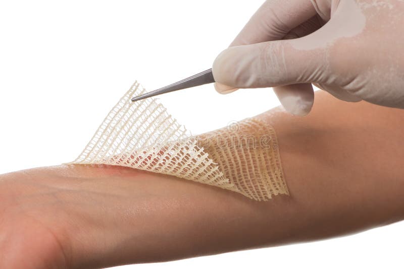 First Aid bandaging hand stock image. Image of white - 41072987