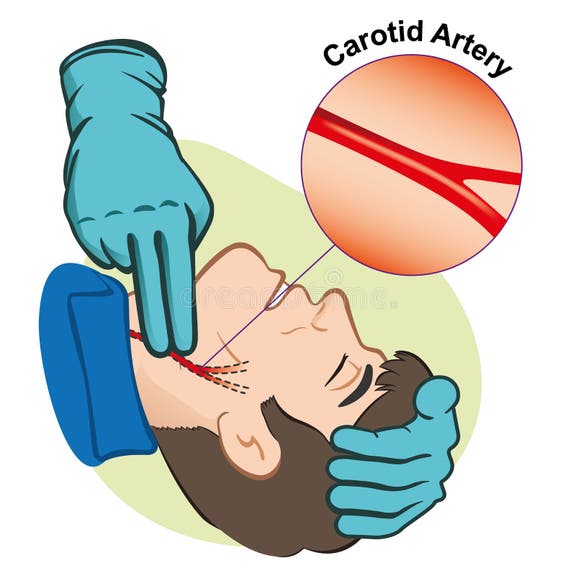 First Aid Illustration Person Measuring Pulse through the Carotid ... First Aid Illustration Person Measuring Pulse through the Carotid ...