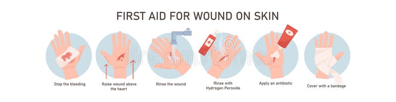First Aid for Wound on Skin Stock Vector - Illustration of health ...