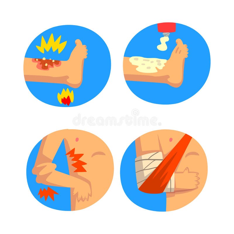First Aid for Wounded Arm and Leg in Blue Circle Vector Set Stock ...